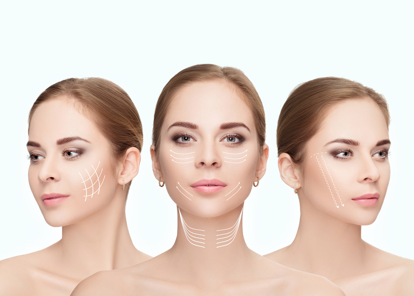 Tout savoir sur le lifting sans chirurgie – Net femme